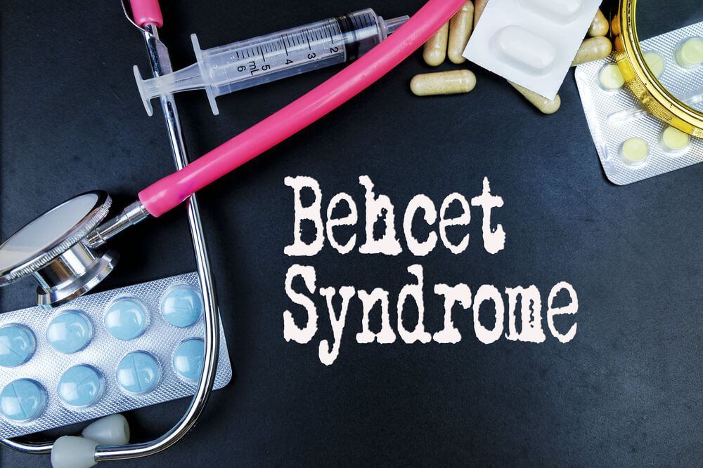Boala Behcet sau sindromul „Drumul Mătăsii”: manifestări clinice ...